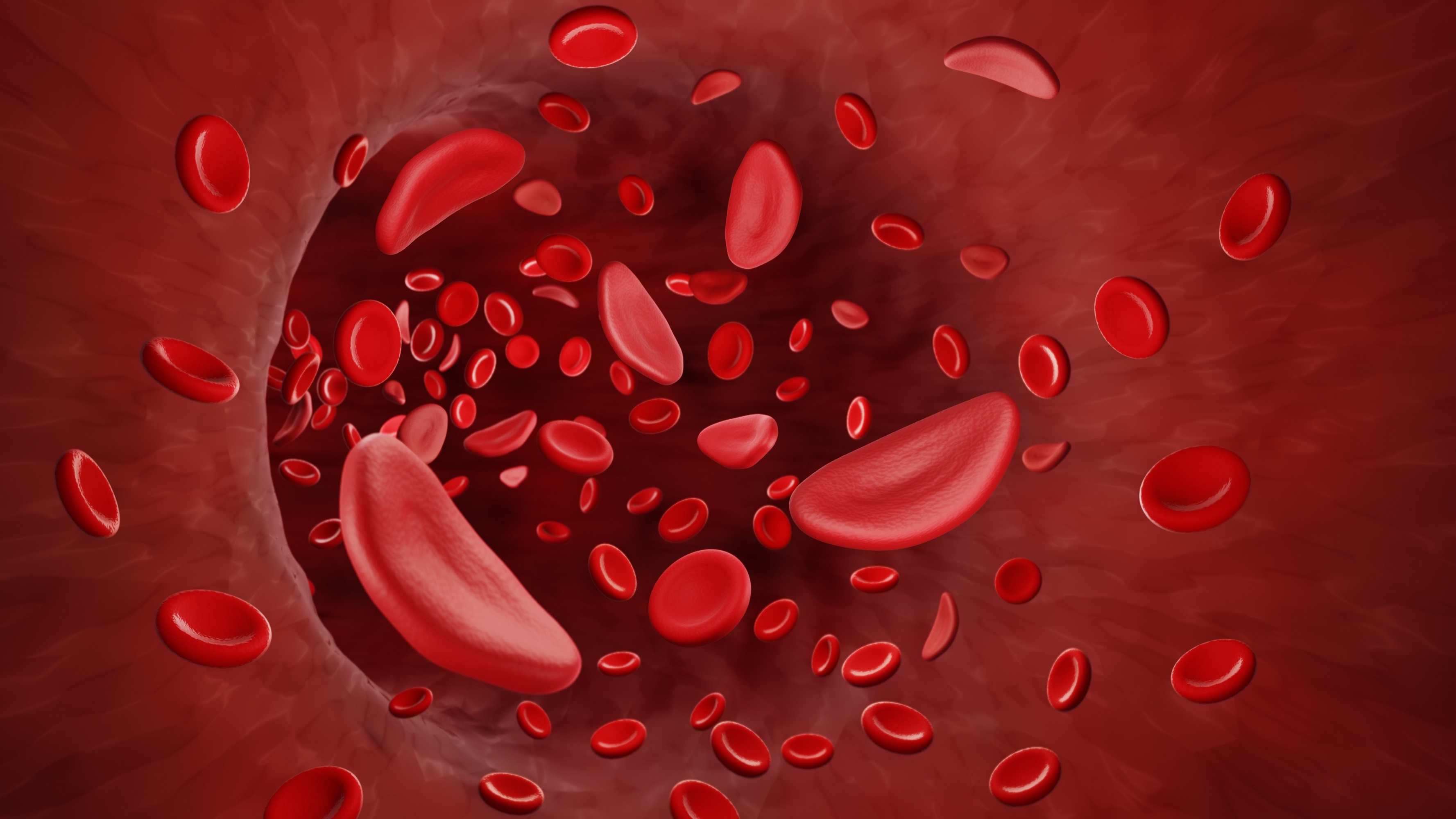 Sickle Cell Anaemia SCA Elimination Mission 2047 Sickle Cell Anaemia SCA Elimination Mission 2047